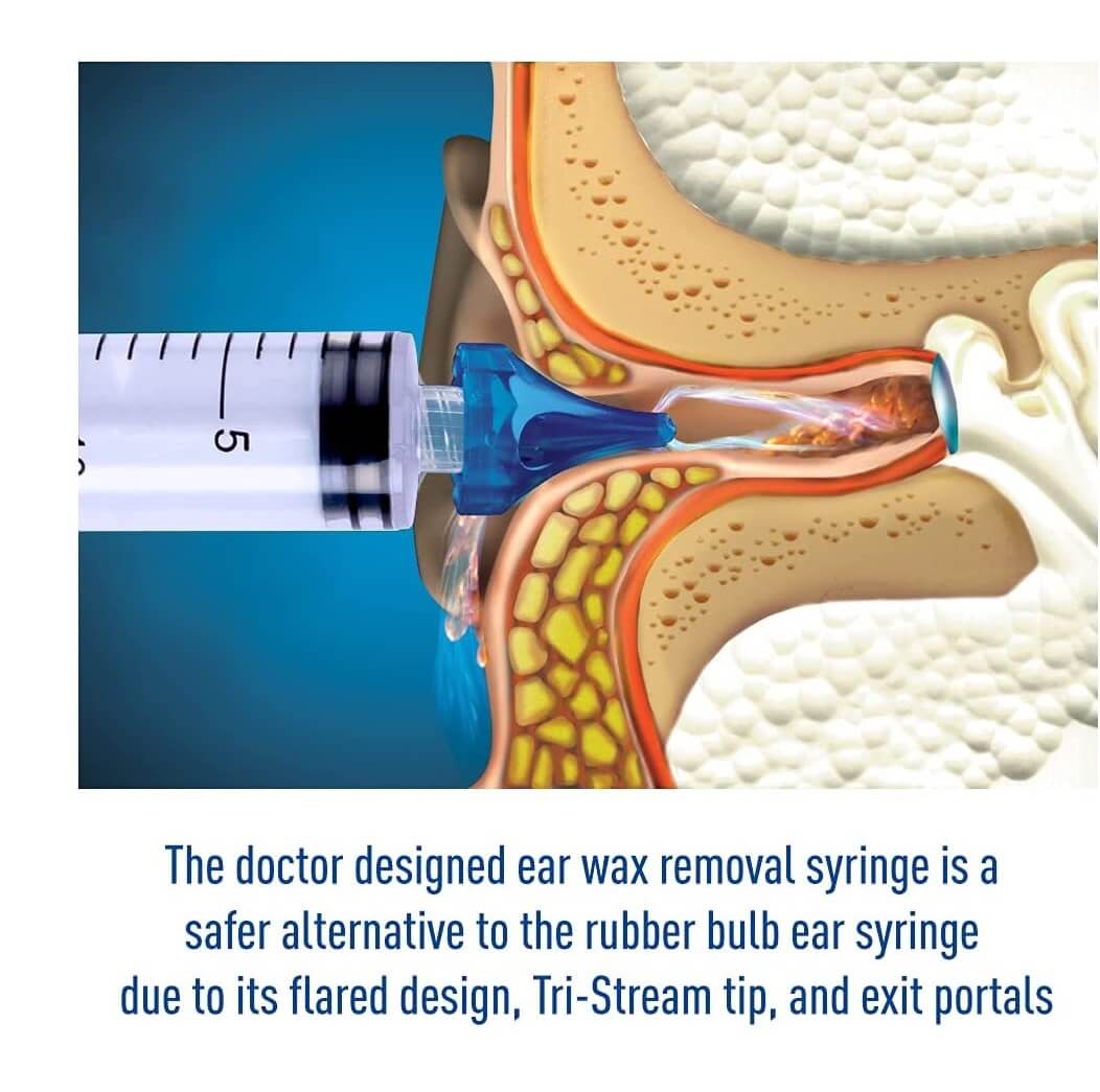 Acu-Life Earwax Removal Syringe – Safely Flush Ears To Remove Earwax ...