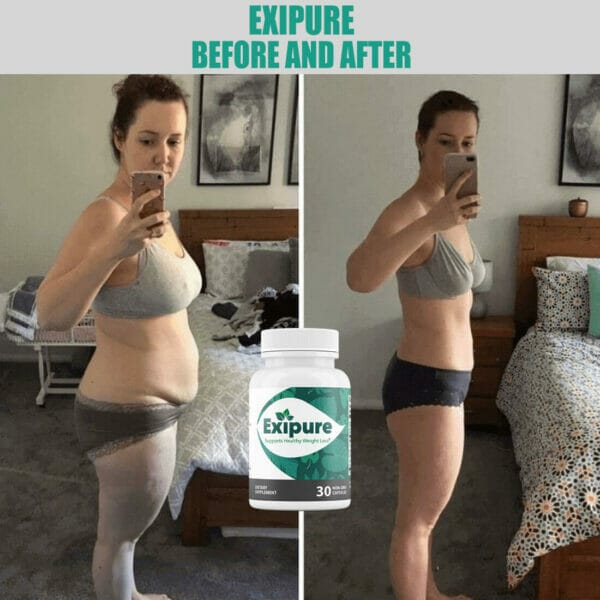 Exipure Review (2024) - Does It Really Work For Weight Loss?