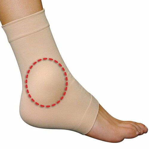 PediFix Visco-gel Ankle Bone Protection Sleeve – Relieves Ankle Pain ...