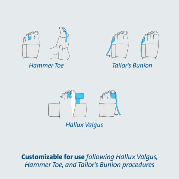 DARCO Toe Alignment Splint – Supports Post-Operative Toe Alignment And ...